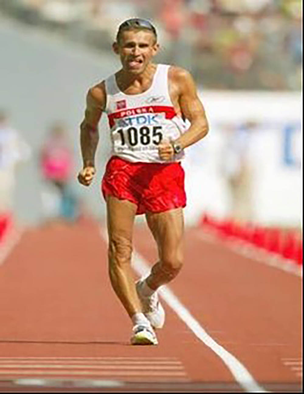 Bow Legged Athletes Do Bow Legs Get Worse With Age?